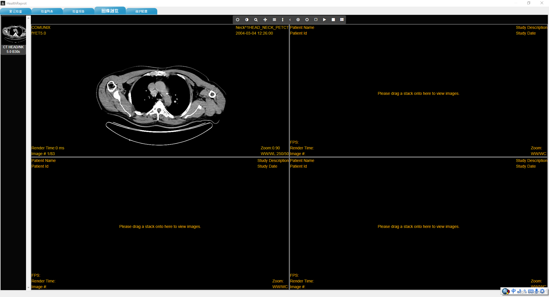 【2024-01-15 第三次更新版】简易PACS系统模拟搭建（仅供参考学习）_pacs c++开源源码下载-CSDN博客