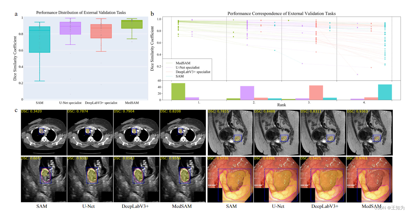 nature论文Segment anything in medical images_medsam: segment anything in ...