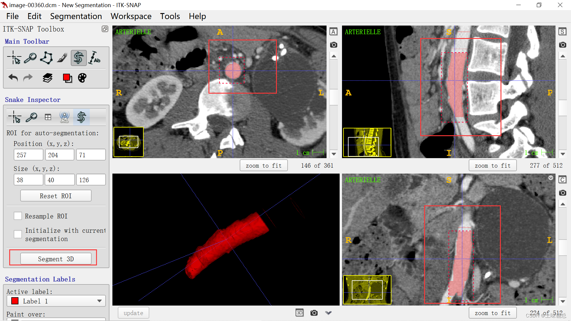ITK-SNAP的学习（二）感兴趣区域的勾画-CSDN博客
