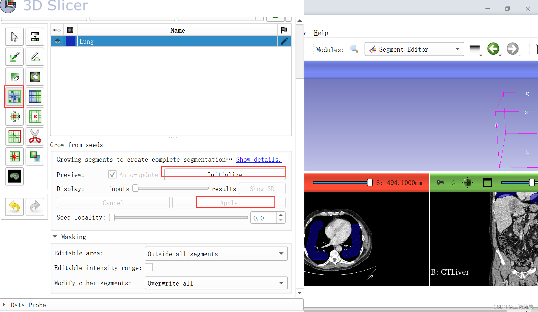 3D Slicer的学习（二） 图像的分割_3dslicer裁剪-CSDN博客