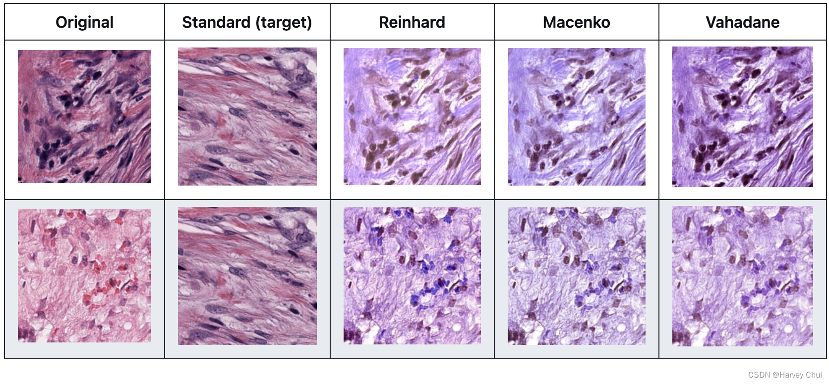 【代码已开源】基于Python的全切片(WSI)染色归一化工具，实现了reinhard, macenko, vahadane共三种方法 ...