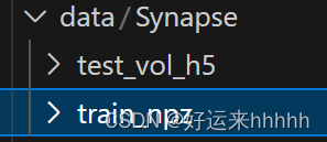 Transunet复现_transunet复现测试出错-CSDN博客