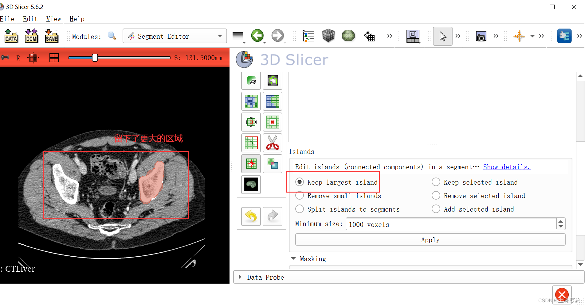 3D Slicer的学习（二） 图像的分割_3dslicer窗宽窗位-CSDN博客