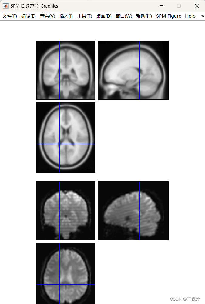 学习笔记 | 脑科学入门 | fmri 数据预处理_g, fnirs, fmri, dti, meg等脑影像数据的处理-CSDN博客