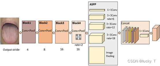 舌象分割：自己改进的Deeplabv3_an improved tongue image segmentation model based -CSDN博客