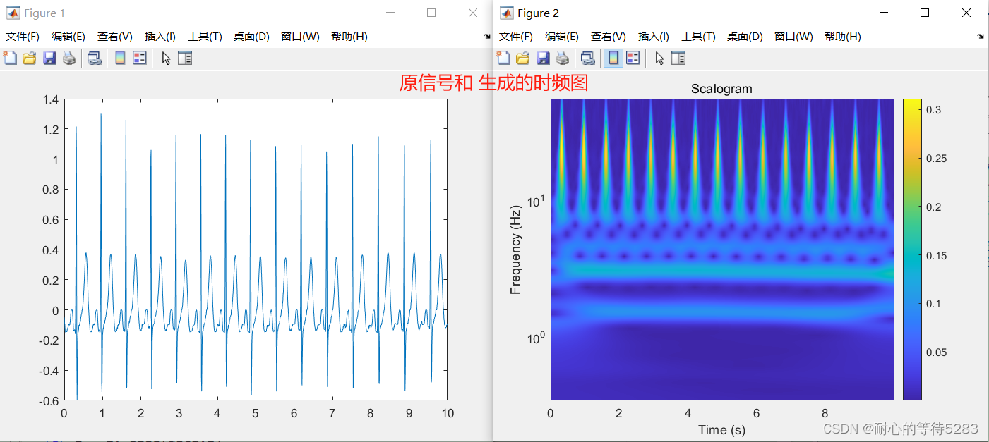 【Matlab基于连续小波变换（CWT），将信号生成时频图】_连续小波变换时频图-CSDN博客
