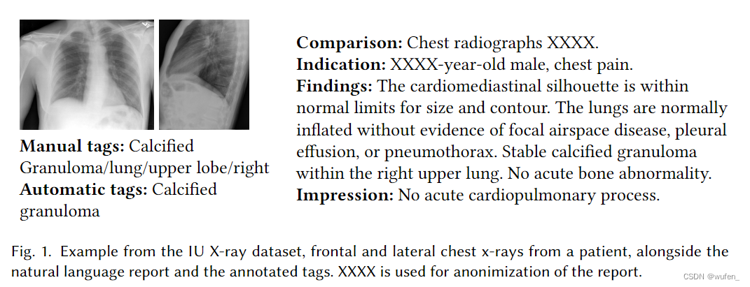 【论文笔记】A Survey on Deep Learning and Explainability for Automatic Report ...