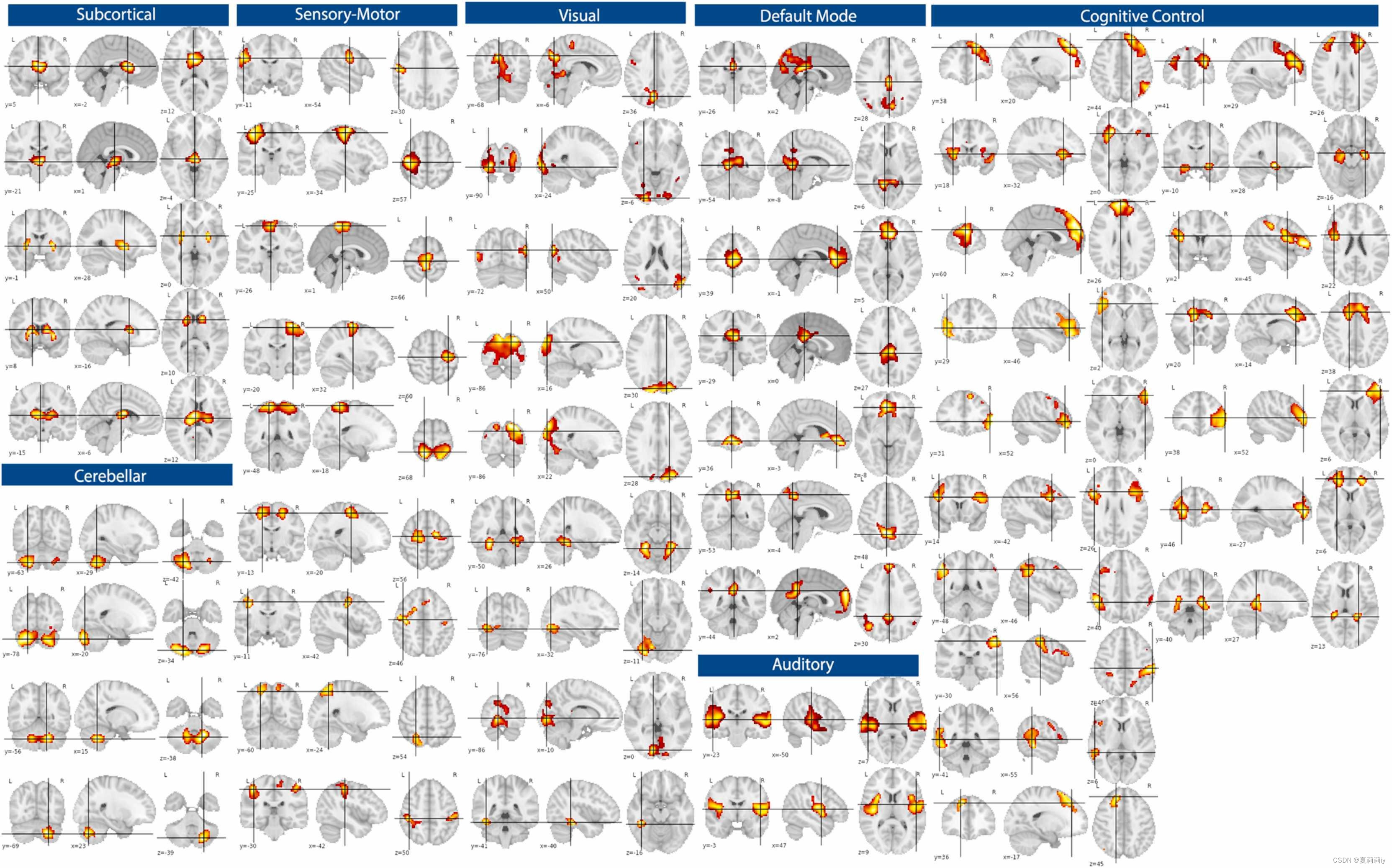 [论文精读]A novel 5D brain parcellation approach based on spatio-temporal ...
