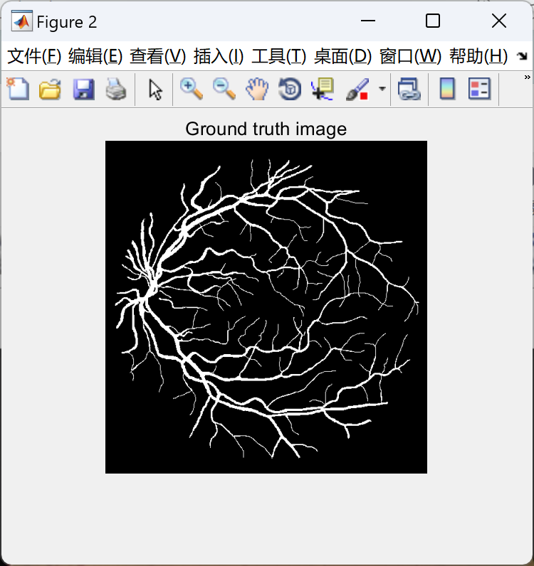 【图像分割】视网膜图像分割以提取血管的复杂结构（matlab实现）matlab血管分割 Csdn博客