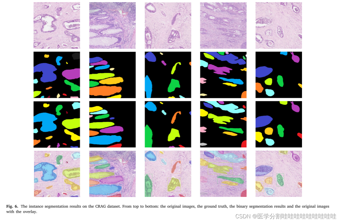 Enhancing gland segmentation in colon histology images using aninstance-aware diffusion model-CSDN博客