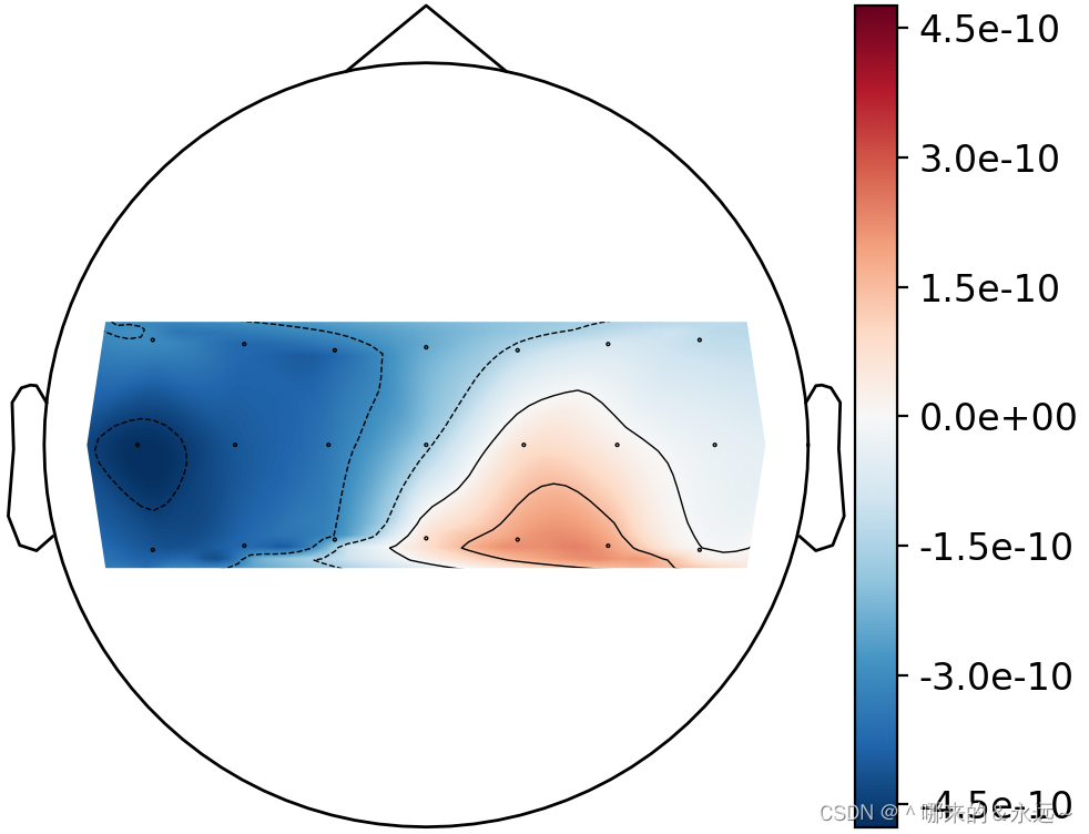 python绘制局部EEG导联的脑地形图_python brainflow 脑地形图-CSDN博客