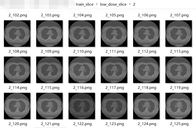 读取mhd、raw图像并切片、归一化、保存_mhd文件-CSDN博客