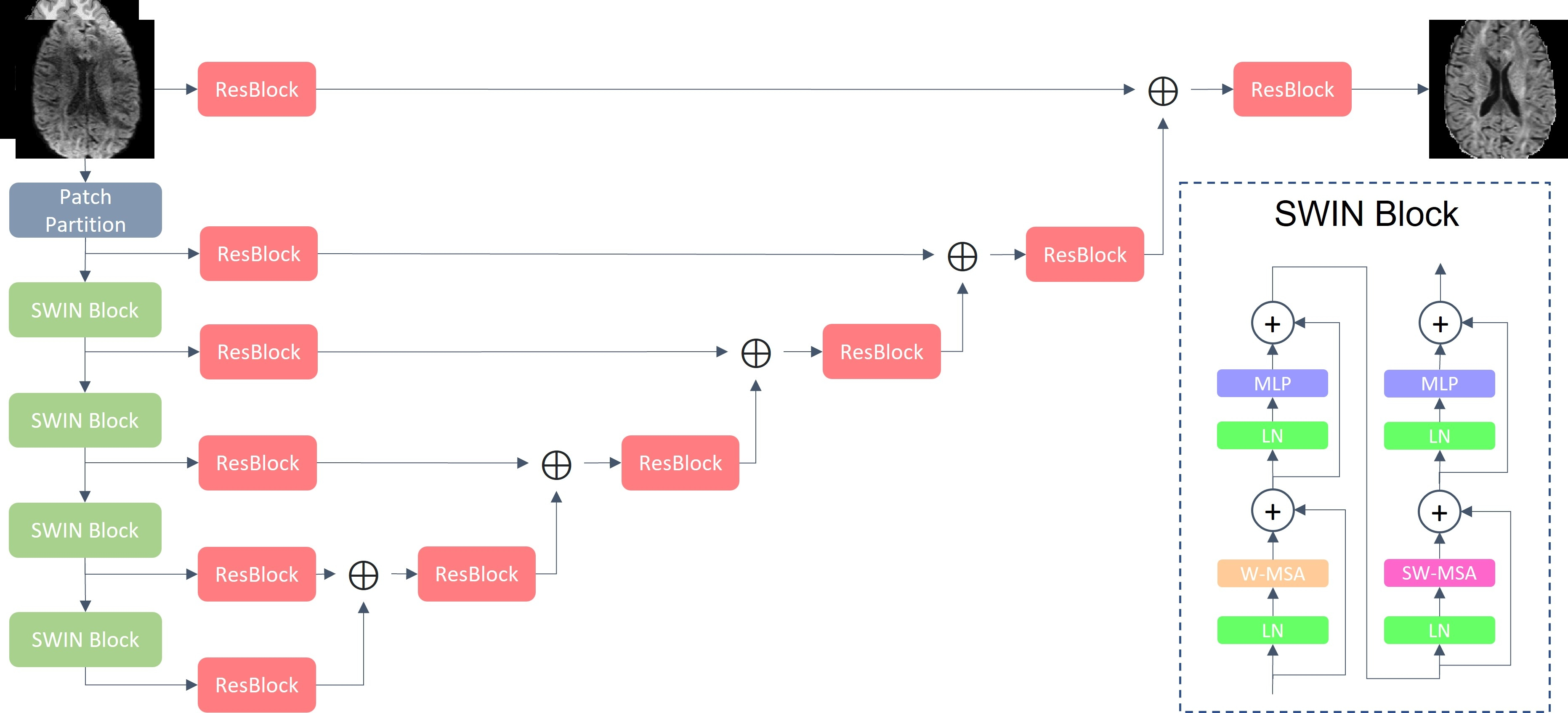Generalized Diffusion MRI Denoising and Super-Resolution using Swin Transformers_swin ...