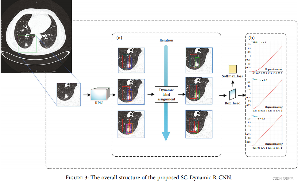论文翻译：SC-Dynamic R-CNN: A Self-Calibrated Dynamic R-CNN Model for Lung Cancer Lesion Detection ...