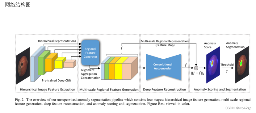 DFR: Deep Feature Reconstruction for Unsupervised Anomaly Segmentation-CSDN博客