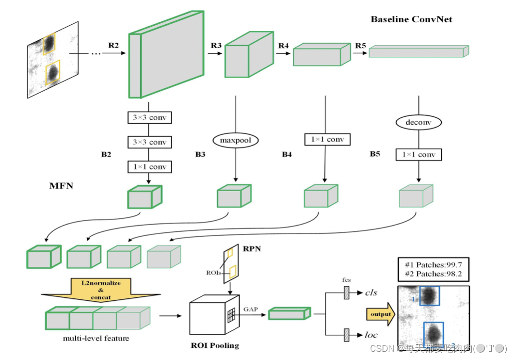 An End-to-End Steel Surface Defect Detection Approach via Fusing Multiple Hierarchical Features ...