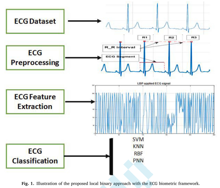【重要】ECG identification_ecg身份认证算法-CSDN博客