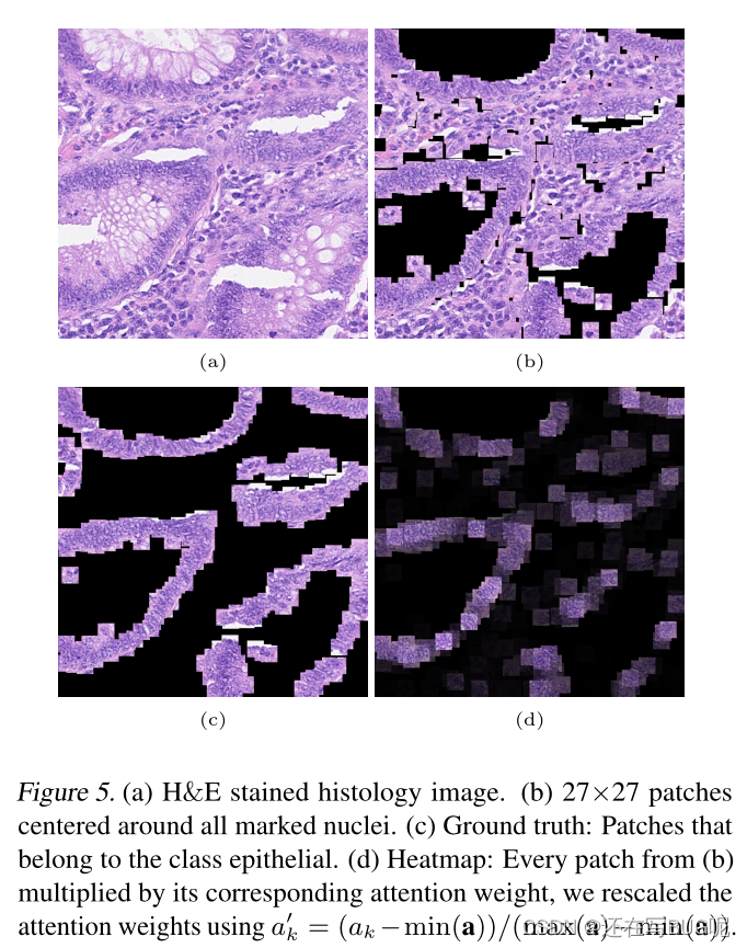 Attention-based Deep Multiple Instance Learning-CSDN博客