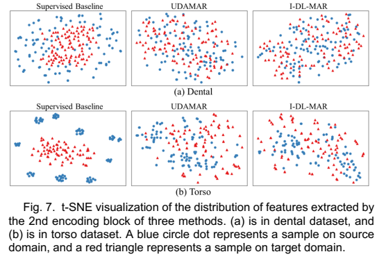 Metal Artefact Reduction with Unsupervised Domain Adaptation Regularization for Practical CT ...