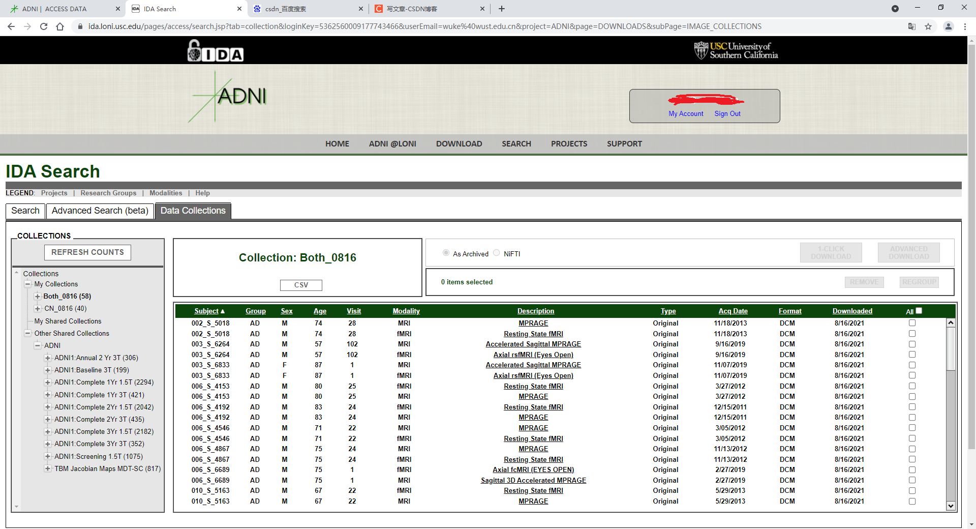 ADNI数据集下载方法（完全步骤）-CSDN博客
