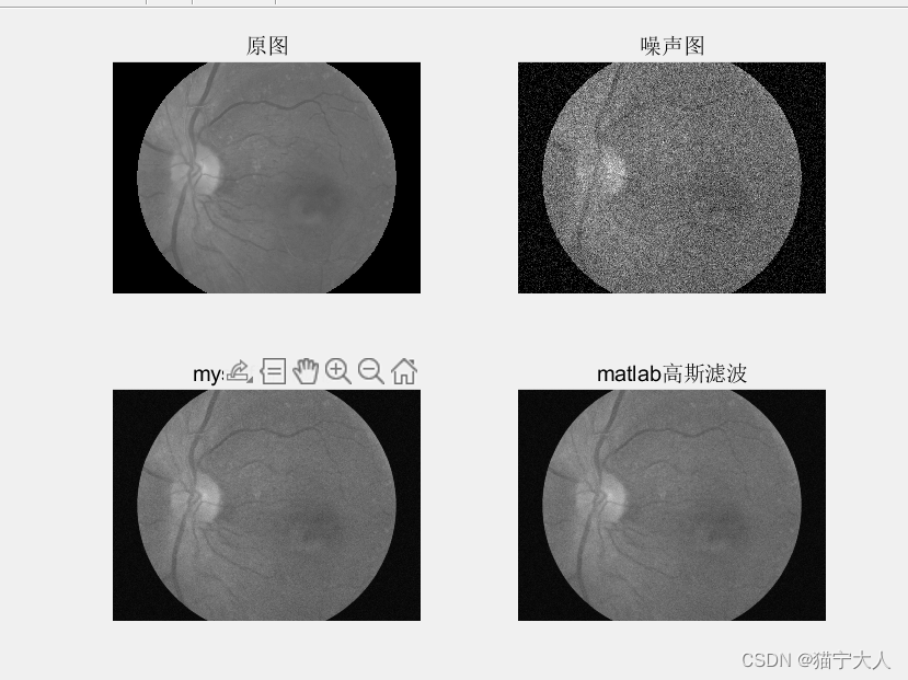 Matlab实现图像滤波 高斯滤波matlab高斯滤波 Csdn博客 