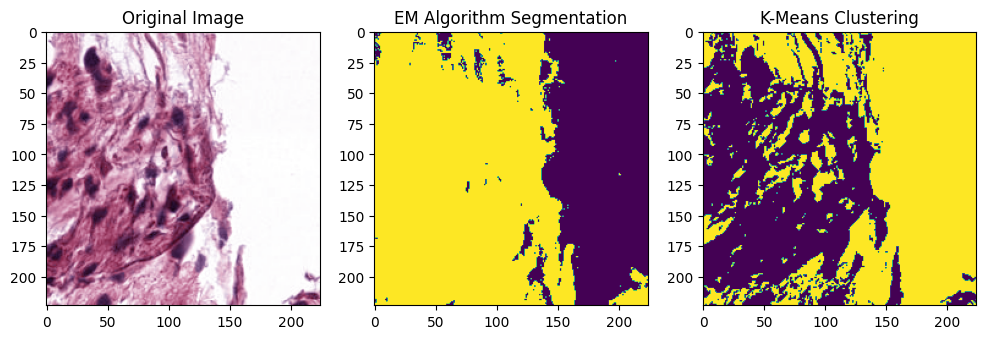 【ML\CV\segmentation】EM算法&CRF模型在图像分割领域中的应用 || 学习笔记_em算法在图像处理-CSDN博客