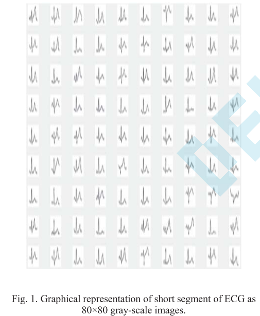 【重要】ECG identification_ecg身份认证算法-CSDN博客
