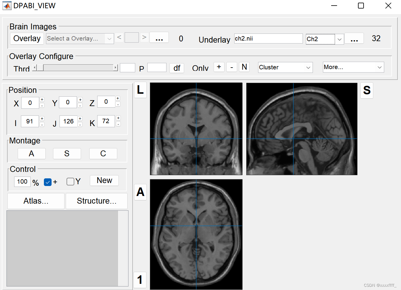 dpabi viewer使用-CSDN博客