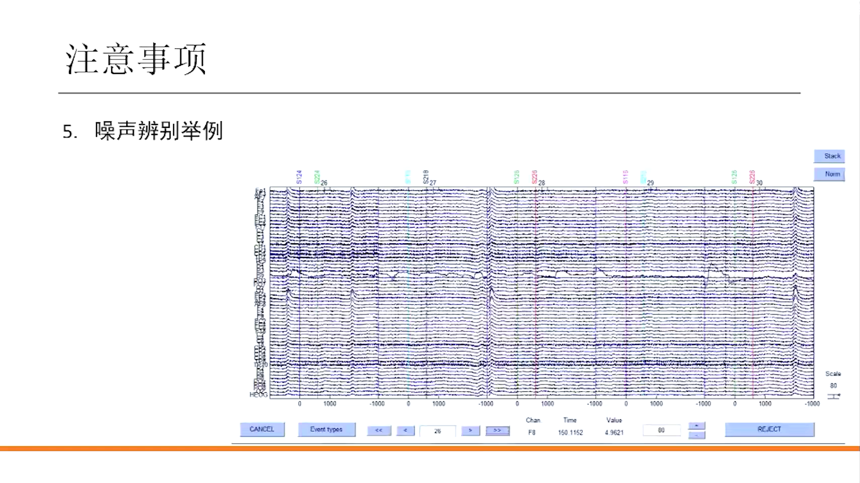 脑电的神经起源与测量-EEG Processing and Feature 2_脑电测试 csdn-CSDN博客