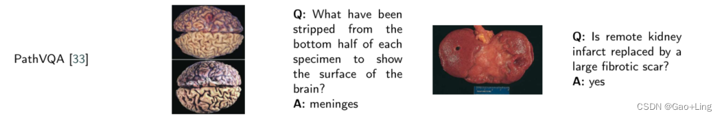 医学视VQA——综述_vqa-rad-CSDN博客