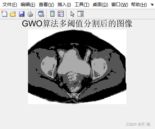 【图像分割】基于灰狼优化算法gwo的otsu多阈值图像分割大津法【matlab代码6】基于灰狼算法的otsu图像多阈值分割程序 Csdn博客
