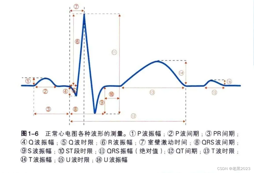 心电图基础之P-QRS-T波形-CSDN博客
