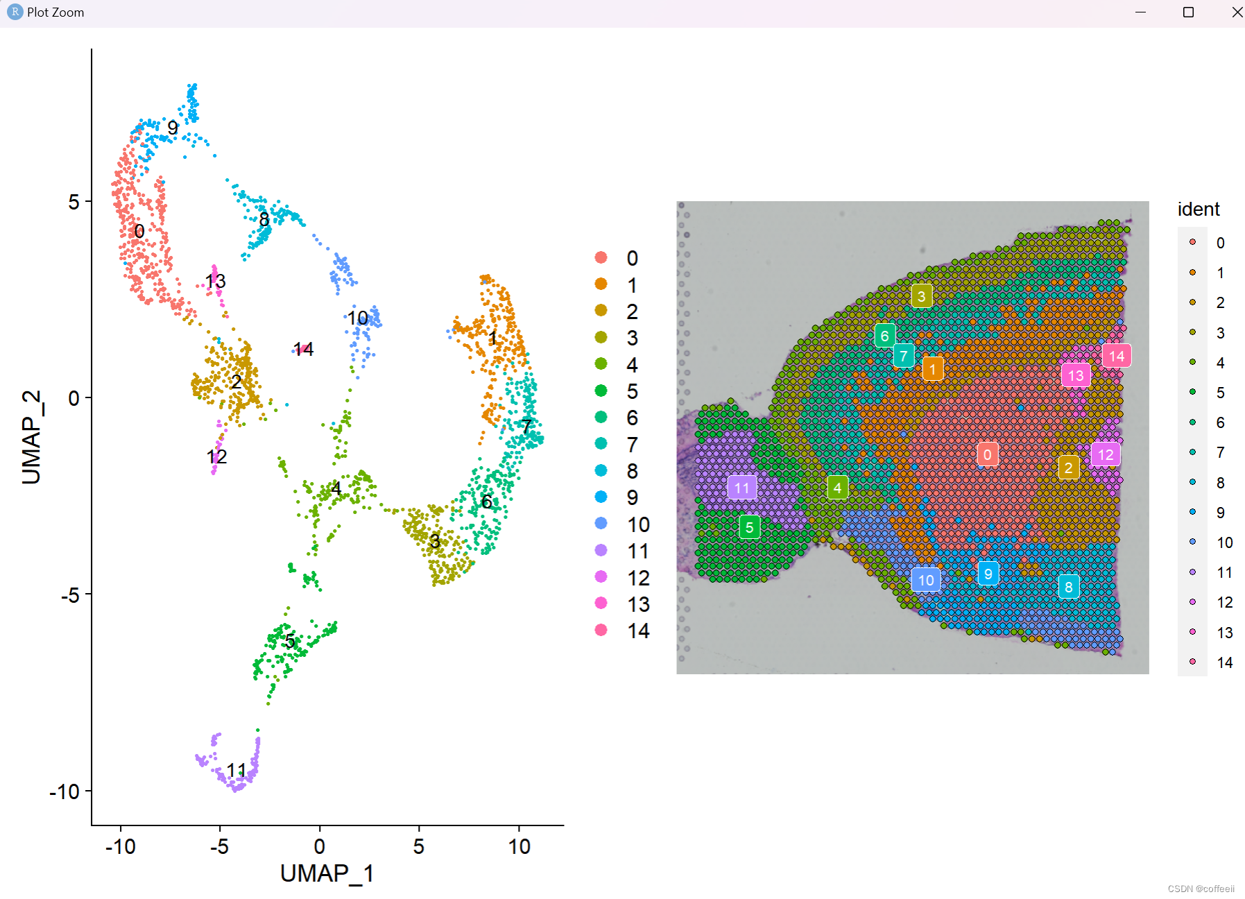跟着Seurat官网学空间转录组（10X数据集为例，包含细胞映射，无监督学习）_seurat空间转录组-CSDN博客