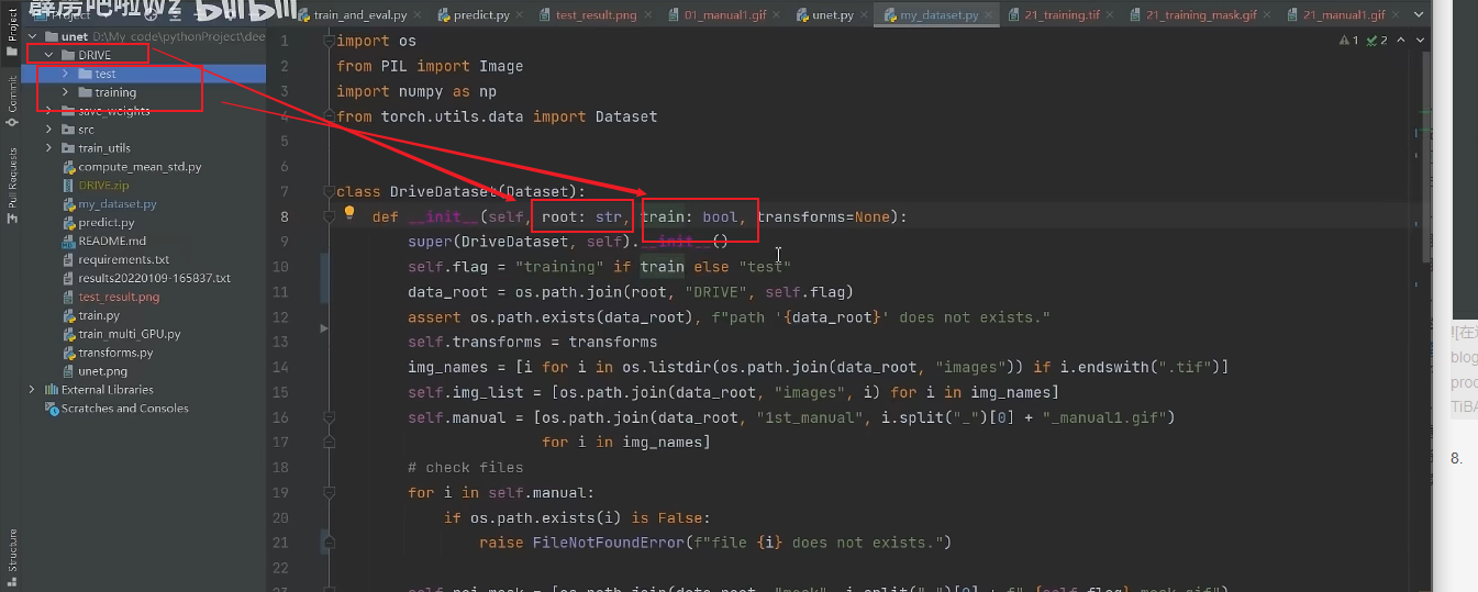 使用Pytorch搭建U-Net网络并基于DRIVE数据集训练(语义分割)学习笔记-CSDN博客