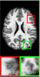 OpenCV图像后处理程序——局部放大并拼接_cv2.resize 拼接图片-CSDN博客