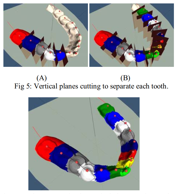 【文献阅读】20210913-20210917文献阅读_singletooth modeling for 3d dental model-CSDN博客