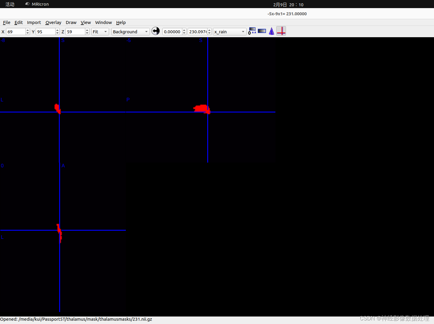 如何从已知的模板中提取需要的二值化的mask（fslmaths）_怎么将mask图像变成二值图像-CSDN博客