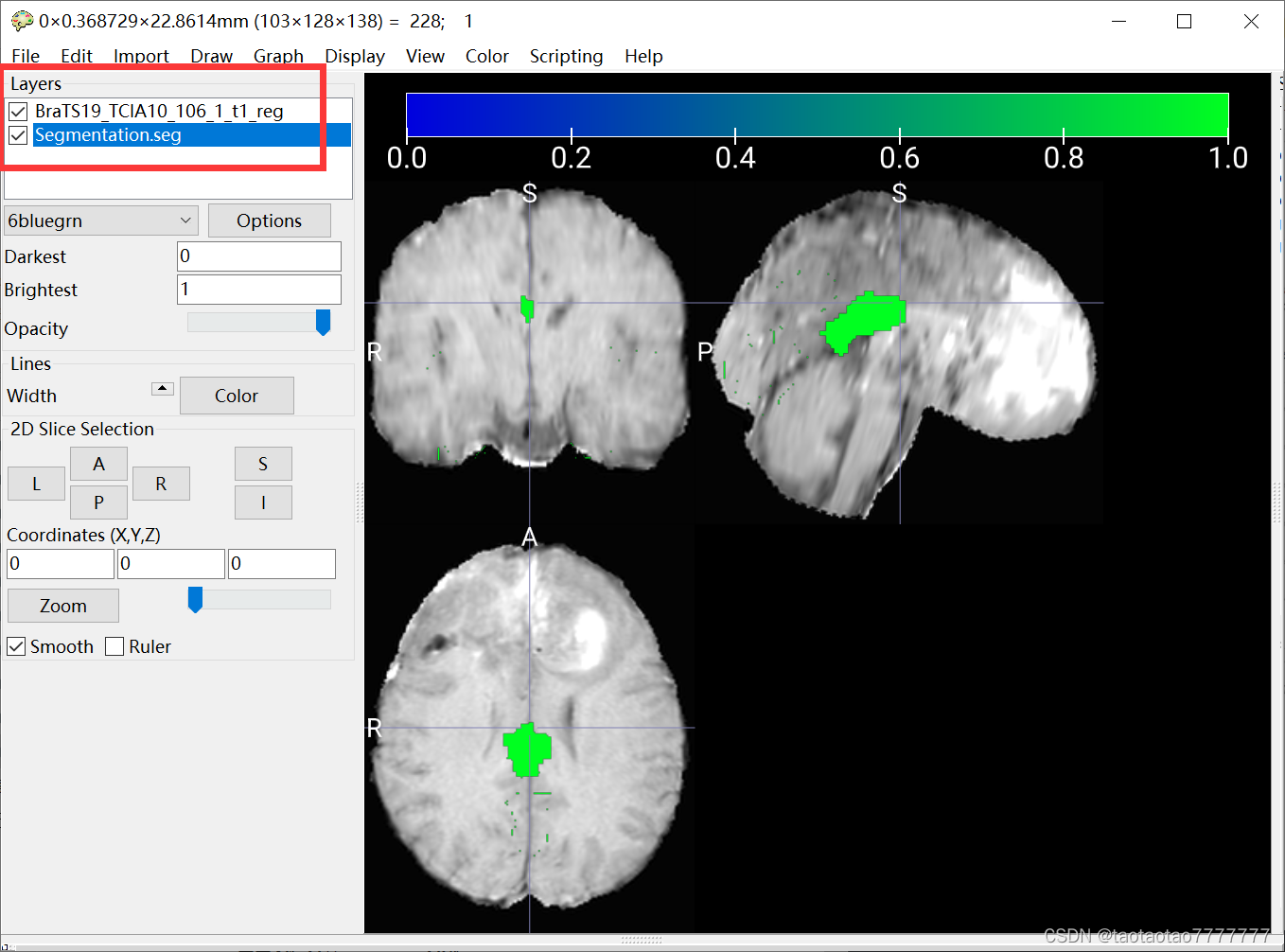 【影像组学】基于 atlas 感兴趣区提取 (3D slicer)_3dslicer 生成标准头模-CSDN博客