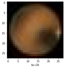 RetinaMnist数据集介绍以及下载、使用-CSDN博客