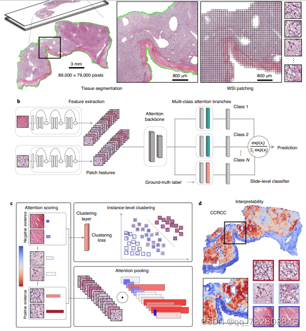 （WSI分类）WSI分类文献小综述_scaling vision transformers to gigapixel images vi-CSDN博客