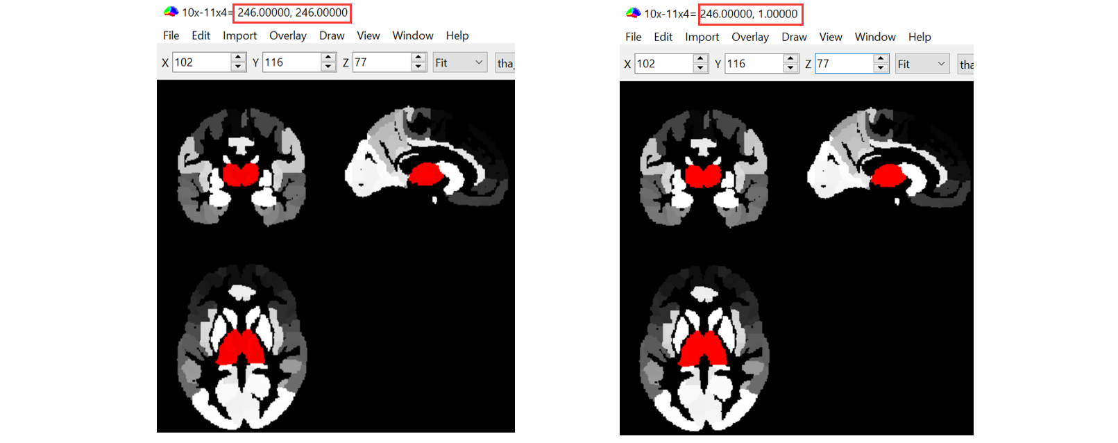 MRI脑影像分析——根据脑图谱获取感兴趣区域mask，以海马体与丘脑为例(matlab+nilearn+nibabel+REST1.8 ...