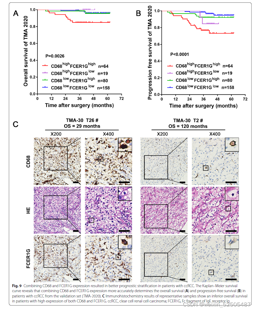 文献阅读-FCER1G与透明细胞癌中巨噬细胞的浸润相关并且通过调节肿瘤免疫产生不良预后-CSDN博客