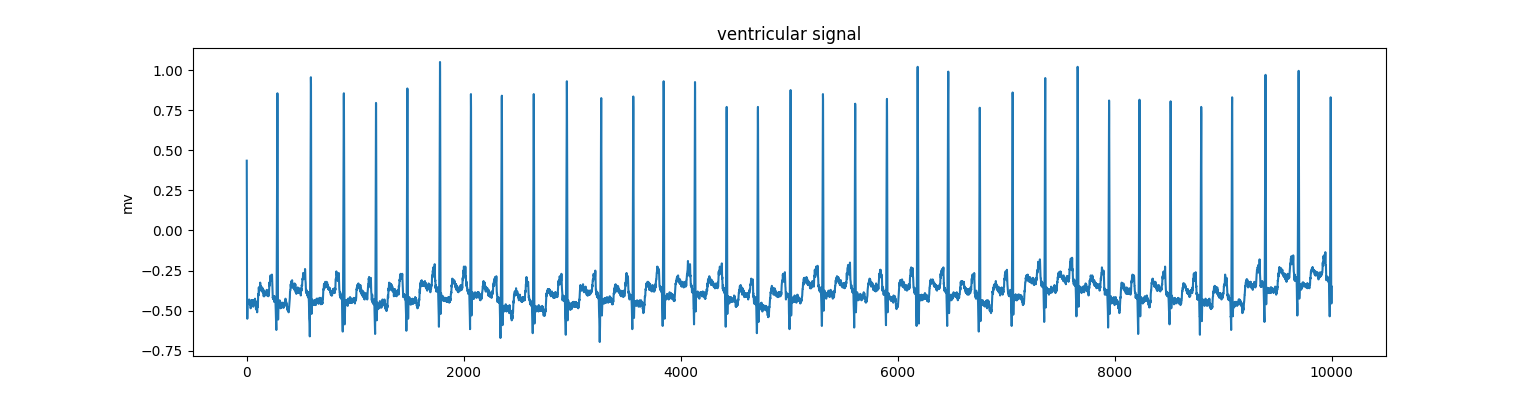 超入门级-基于中值滤波处理ECG信号的基线漂移-Python-MIT-BIH数据集_python_浩浩的科研笔记-华为云开发者联盟