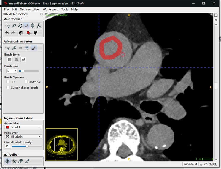 ITK-snap医学图像标注方法（超级详细）——保姆级_itk snap-CSDN博客