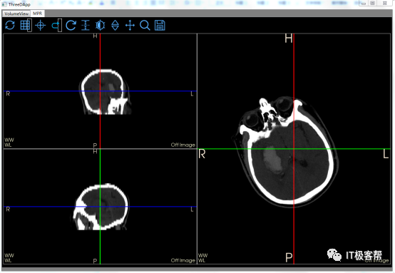 VTK系列教程十一：MPR定位线_vtkreslicecursorwidget-CSDN博客
