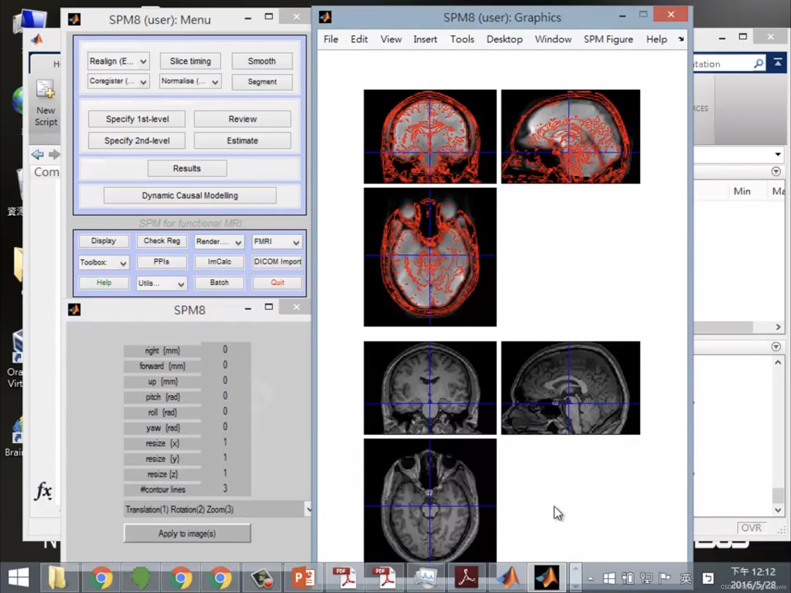 卢家峰课程系列-- advanced rs-fmri analysis 2/6 SPM预处理与batch_rsfmri240个vol怎么处理 ...