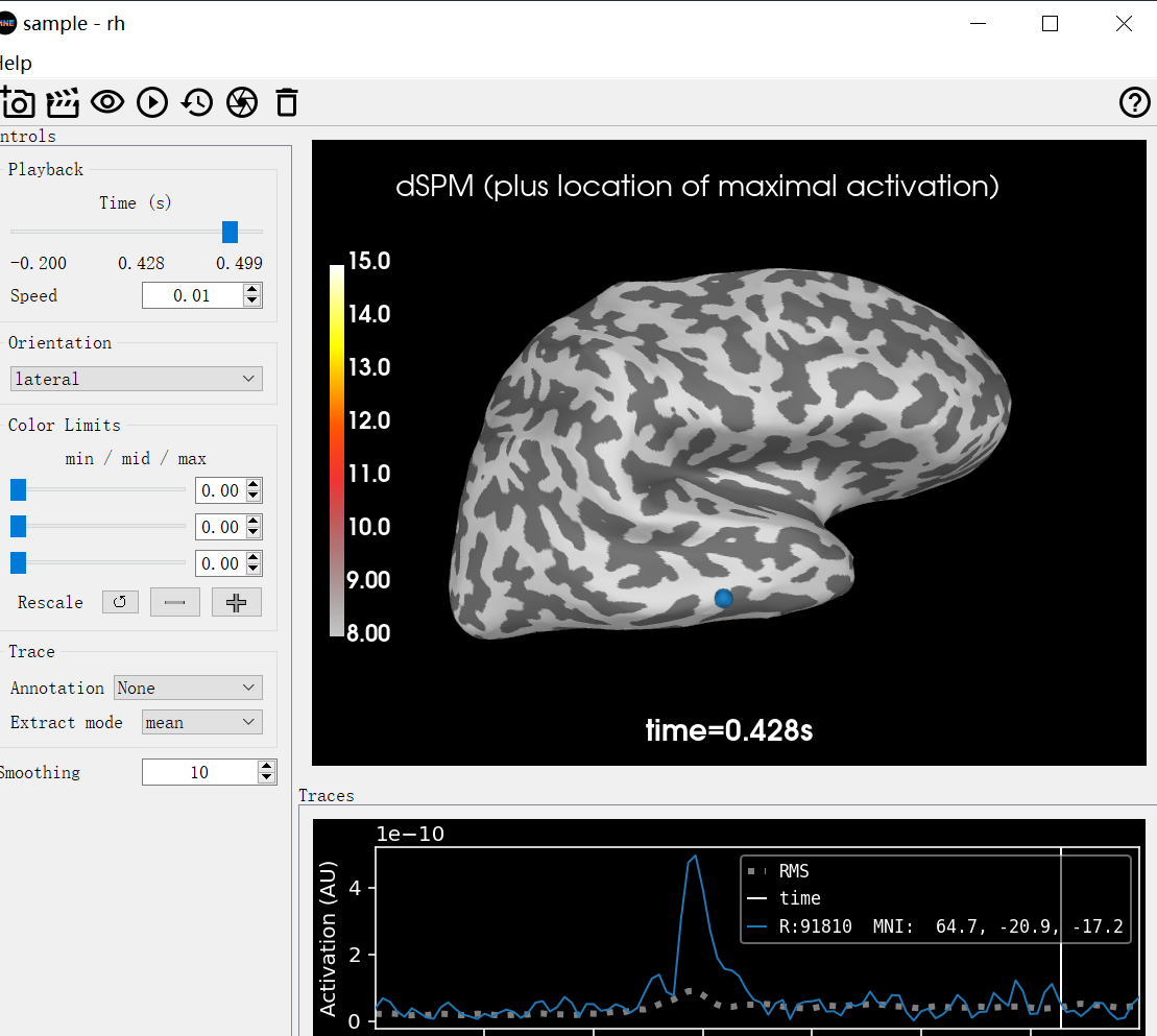 按照MNE进行复现出现的问题记录_mne实现loreta-CSDN博客