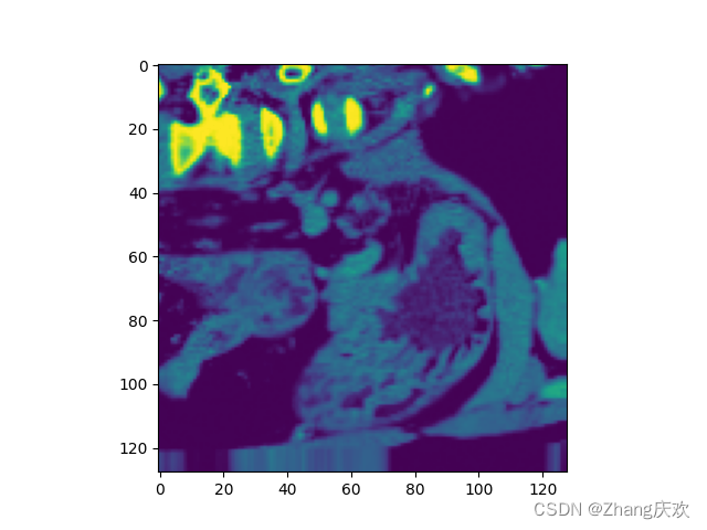 CT数据将.nii格式或.nii.gz格式转换为dcm格式_nii.gz转dicom-CSDN博客