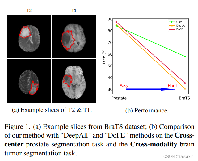 Generalizable Medical Image Segmentation via Style Augmentation and ...