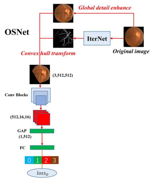 医学图像处理——OTNet论文阅读笔记_keith-wagener眼底分级法中文-CSDN博客